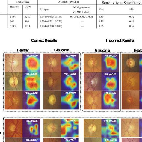 Resnet 50 6 Architecture Where Conv Represents A Convolution Layer