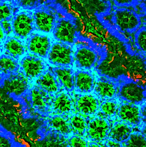 T Lymphocytes In The Colon Light Micrograph Stock Image C051 8266 Science Photo Library