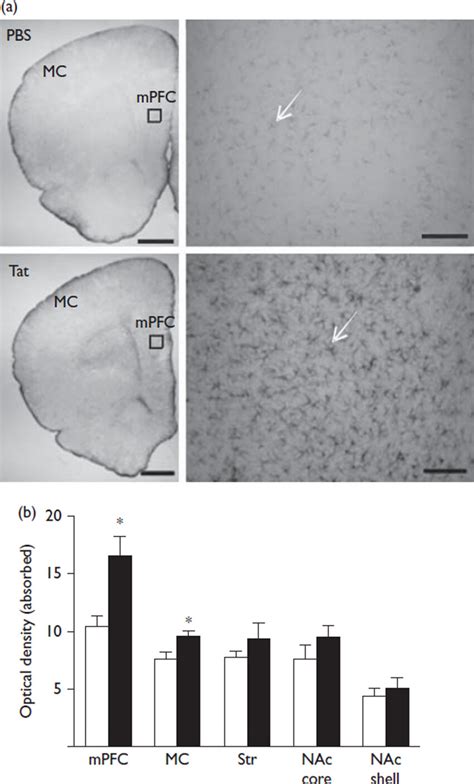 Transactivator Of Transcription Tat Induced Alterations In Glial