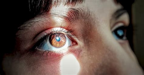 Posterior Vitreous Detachment Causes Symptoms And More