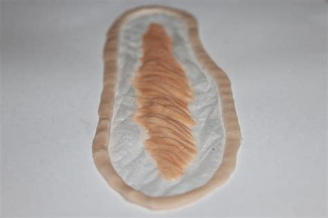 Large Healed Stomach Keloid Scar Thick And Raised Silicone Etsy