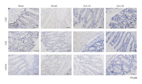 Effects Of Esculentoside A On Hydrogen Sulfidecystathionine γ Lyase