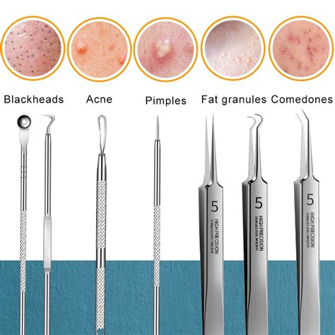 Blackhead Remover Acne Tool Myhomelyproduct
