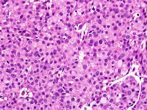 Breast Class Object Detection Dataset By Artificial Intelligence