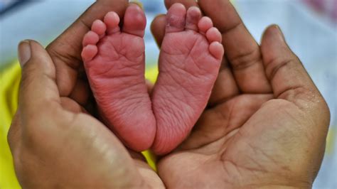 Award Success For The North West Perinatal Optimisation Team Greater