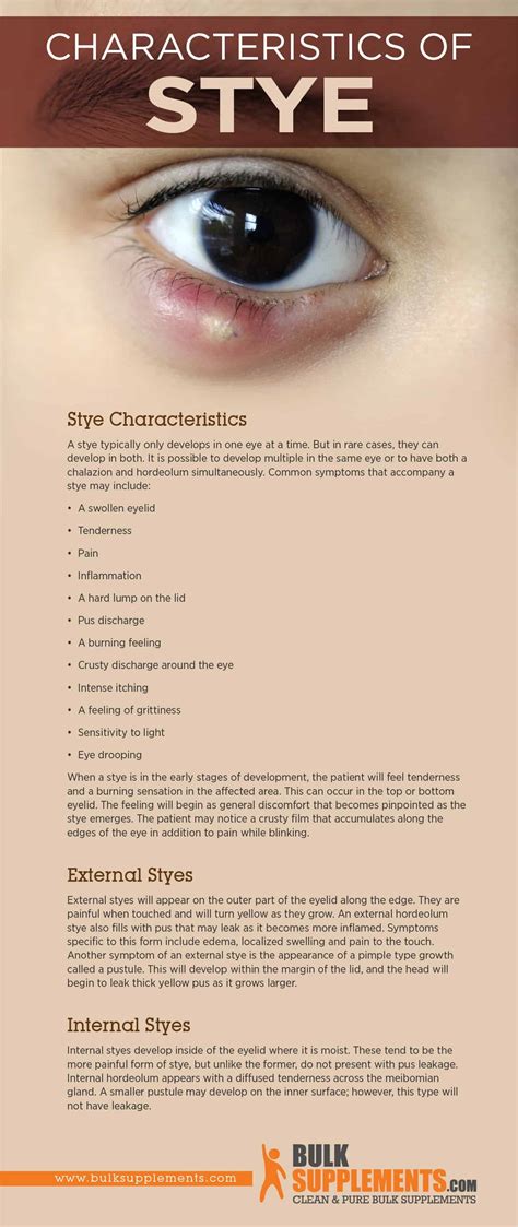 Eye Stye