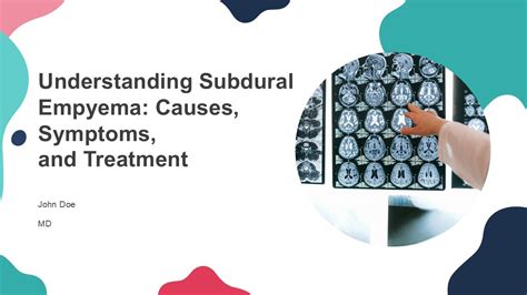 Understanding Subdural Empyema Causes Symptoms And Treatment Ppt Slides