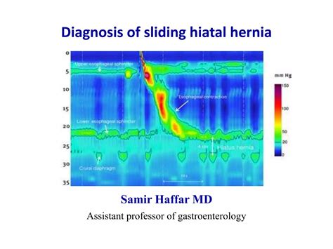 Sliding Hiatal Hernia 3cm