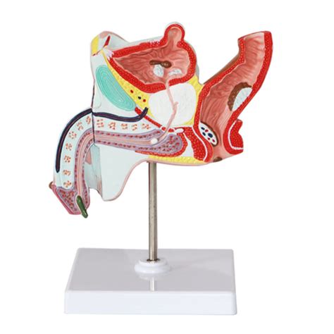 Buy Human Male Genitourinary System Model Male Gonorrhea Model 1 1 Life Size Male Reproductive