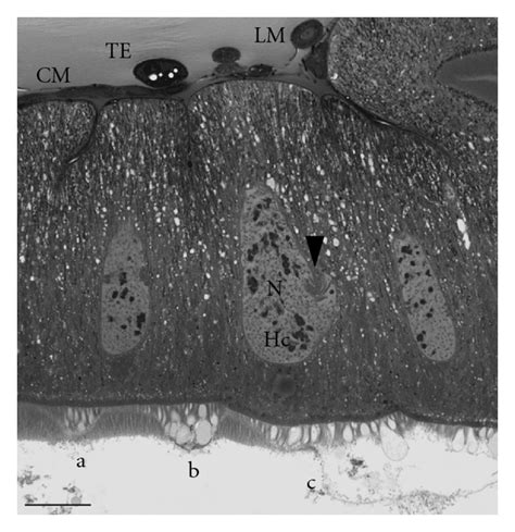 Cross Section Of A Healthy Larval Midgut Epithelial Cells Are
