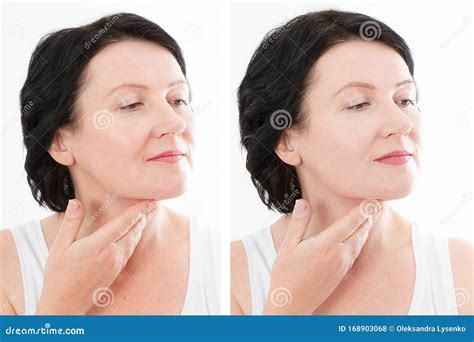 Middle Age Close Up Woman Happy Face Before After Cosmetic Procedures