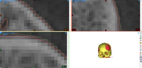 accuracy of segmentation smoothing support 3d slicer community