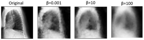 Mv Mff Multi View Multi Feature Fusion Model For Pneumonia Classification