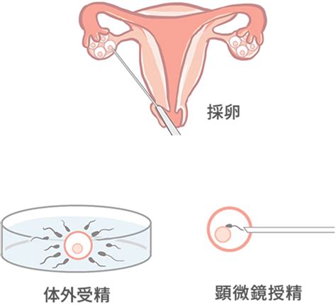 天童市で不妊治療は「さとうウィメンズクリニック」