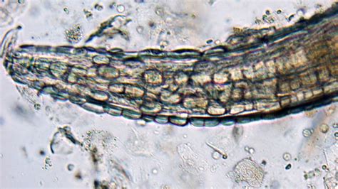 Human Skin Worms