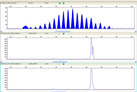 Identiclone Gene Clonality Assay Results From The Buccal Tumour Showing