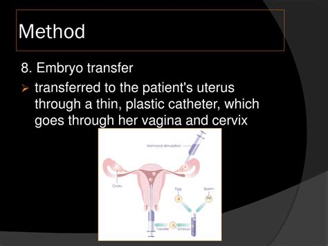 Ppt In Vitro Fertilization Powerpoint Presentation Free Download
