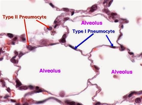 Eastern Black Rhino Structural Hierarchy Cells Pneumocytes
