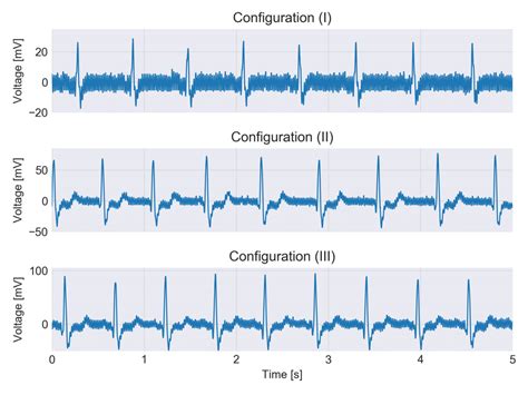 5 Measured Ecg Signals And Their Psd Comparison Of Measured Signal