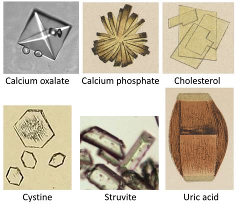 Fileurine Crystals Comparisonpng Wikimedia Commons