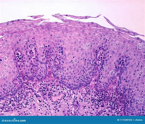 Epithelium Of Esophagus Stock Image Image Of Epithelial 117240105