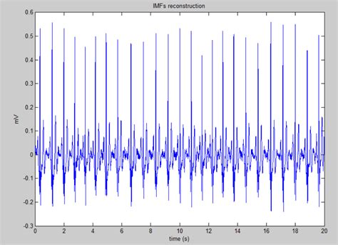 Github Ramiro Gm Cardiac Frecuency And Ecg Signal Denoising By Eemd