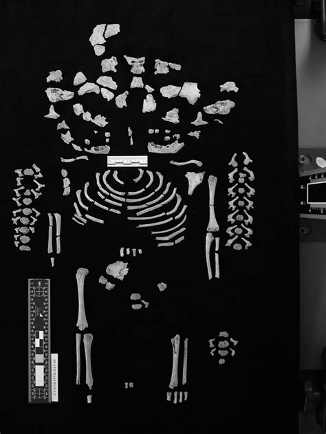 Any Forensic Anthropologists That Can Help Rforensicscience