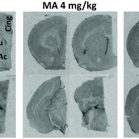 Rat Brain MRI Slices And Three Dimensional Reconstruction A B Coronal Download Scientific