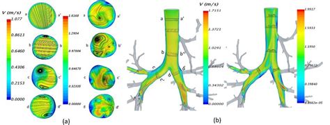 A Secondary Velocity Streamlines With Axial Velocity Contours At