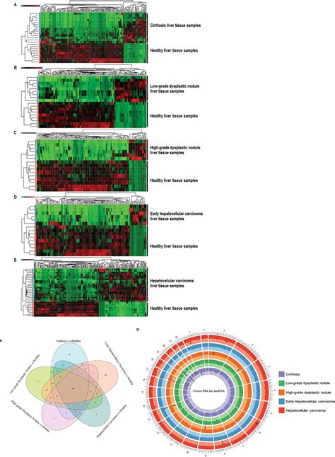 differential expression of long non coding rnas lncrnas in liver