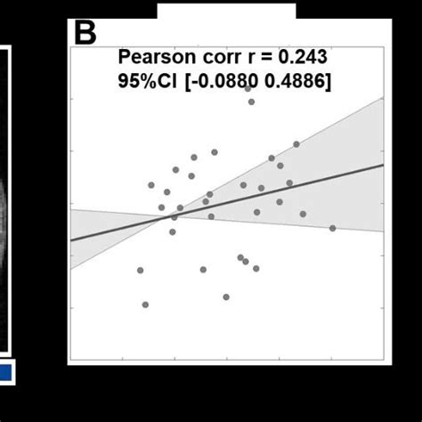 Nodes Of The Direct Segment Of The Right Arcuate Fasciculus Specific To Download Scientific