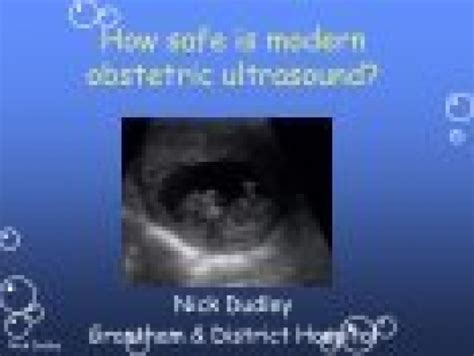 THE BASIC PHYSICS OF ULTRASOUND