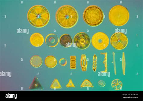 Light Micrograph Of Assorted Species Of Fossil Diatom Shells Here A