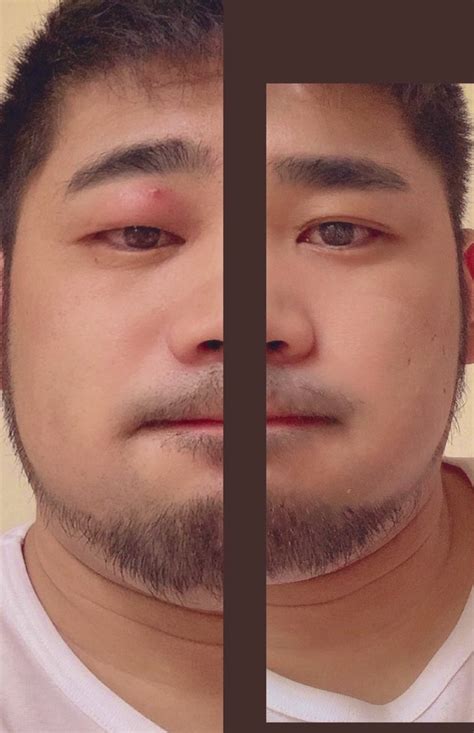 こーた🍈 On Twitter 昔、目がバチくそに腫れて一重になった時に撮ったやつだけど印象が全然違うな