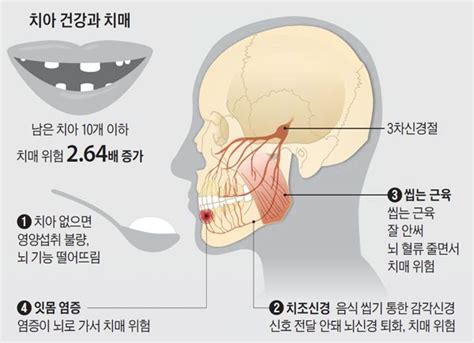 그래픽 뉴스 치아 없으면 감각 신경 자극 안 돼 뇌기능 퇴화 당신의 건강가이드 헬스조선