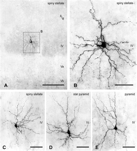 Stellate Neuron