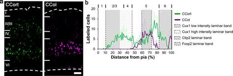 Distribution Of Retrogradely Labeled Corticocortical And Download
