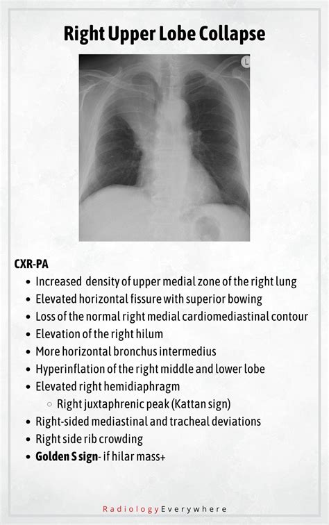 Now You Can Download This Short Radiology Everywhere