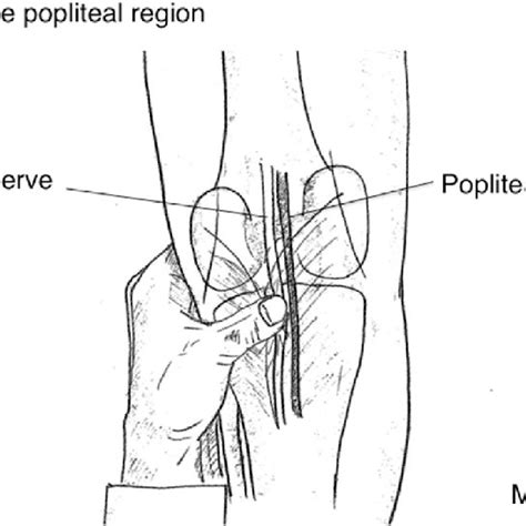 Pdf The Tibial Nerve Compression Test For The Diagnosis Of Lumbar Pdf The Tibial Nerve Compression Test For The Diagnosis Of Lumbar
