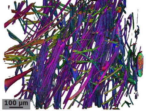 Complex Fibre Analysis Using X Ray Imaging