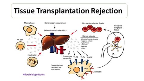 Tissue Transplantation Rejection Microbiology Notes