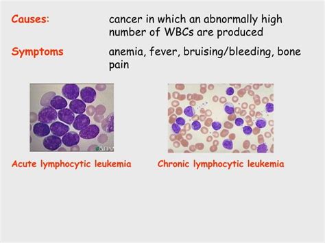 Leukopoiesis Formation Of White Blood Cell PPT