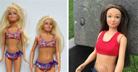 Meet Normal Barbie She Comes Complete With Acne Stretch Marks And