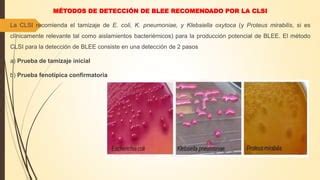 mecanismos de resistencia a los b lactámicos pdf