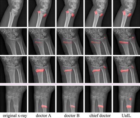 Some Examples Of Different Doctors Annotations And Segmentation From