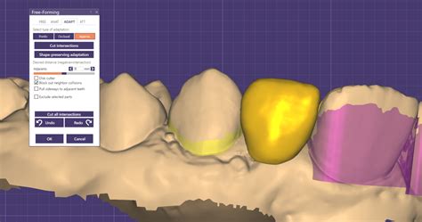 Adapt To Antagonist Adjacent Exocad