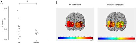 Boosting Prefrontal Brain Responsiveness By Interoceptive Attentiveness During Synchronized