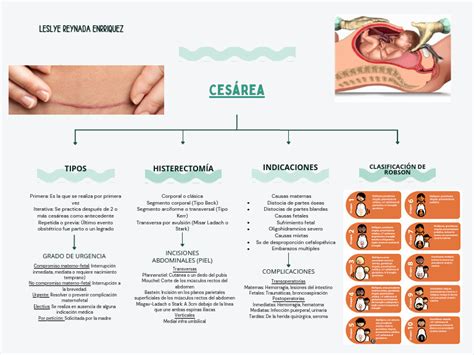 Cesárea Pdf Parto Abdomen