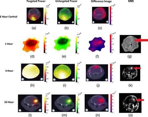 Dual Tracer Background Subtraction Approach For Fluorescent Molecular Tomography