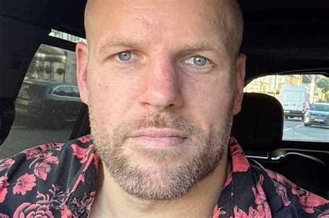 James Haskell Reveals Hair Transplant Results As He Gives Fans A